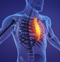 Mid Back & Rib Pain - Back Care Clinic