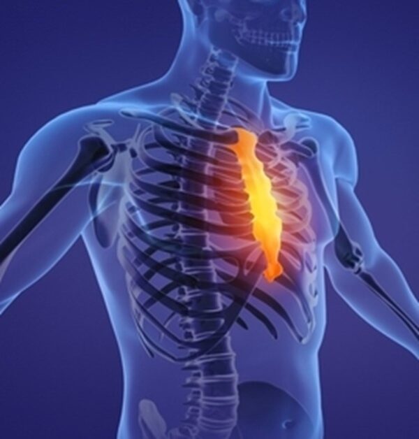 Mid Back & Rib Pain - Back Care Clinic