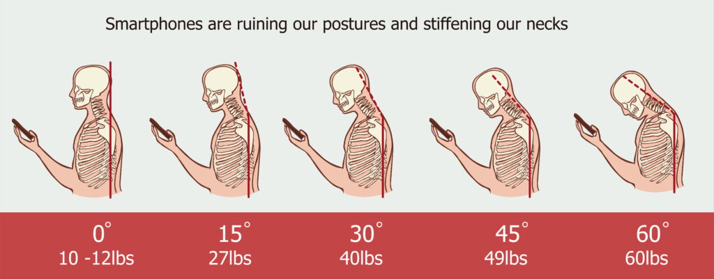 Text Neck: Smartphones and Chiropractic - Back Care Clinic
