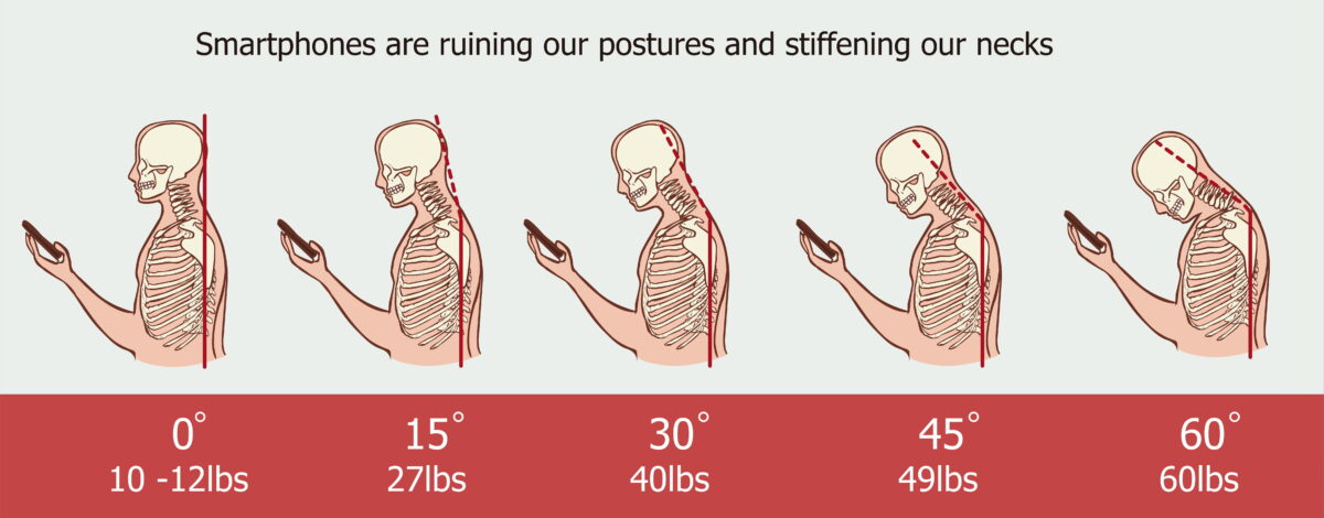Text Neck: Smartphones and Chiropractic - Back Care Clinic