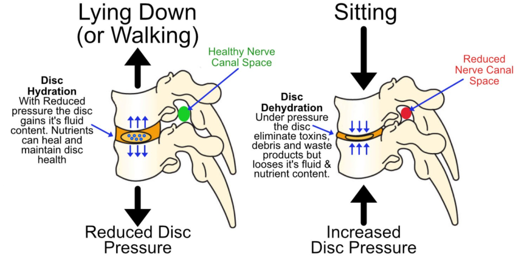 Maintaining Disc Health - Back Care Clinic