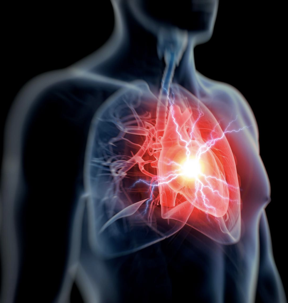 Chest Pain – Rib Strain or Heart Attack? - Back Care Clinic