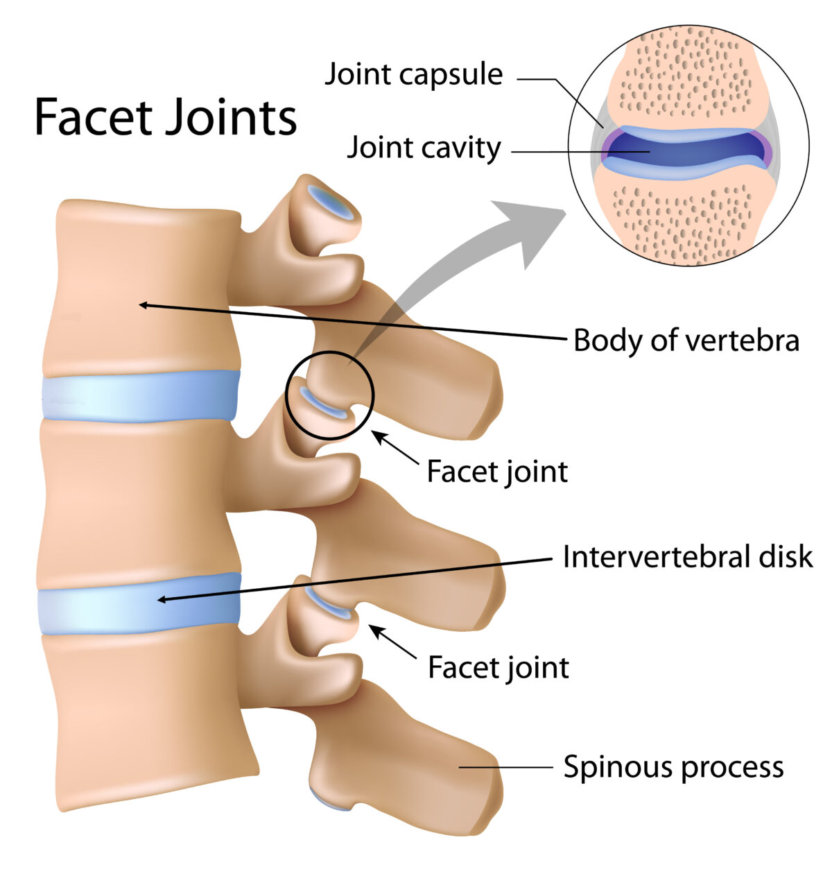Facet Joint Pain - Back Care Clinic