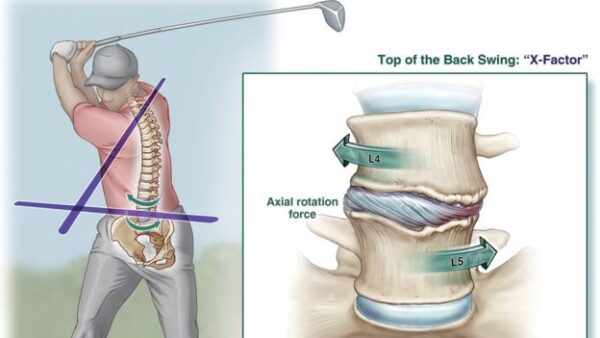 Compression forces on the spine - Back Care Clinic