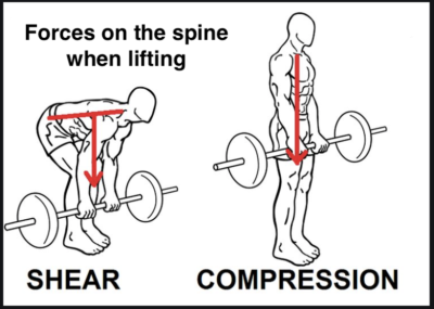 Compression forces on the spine - Back Care Clinic